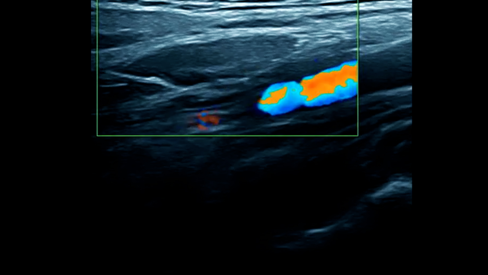 Soft Tissue Ultrasound - The Ultrasound Suite