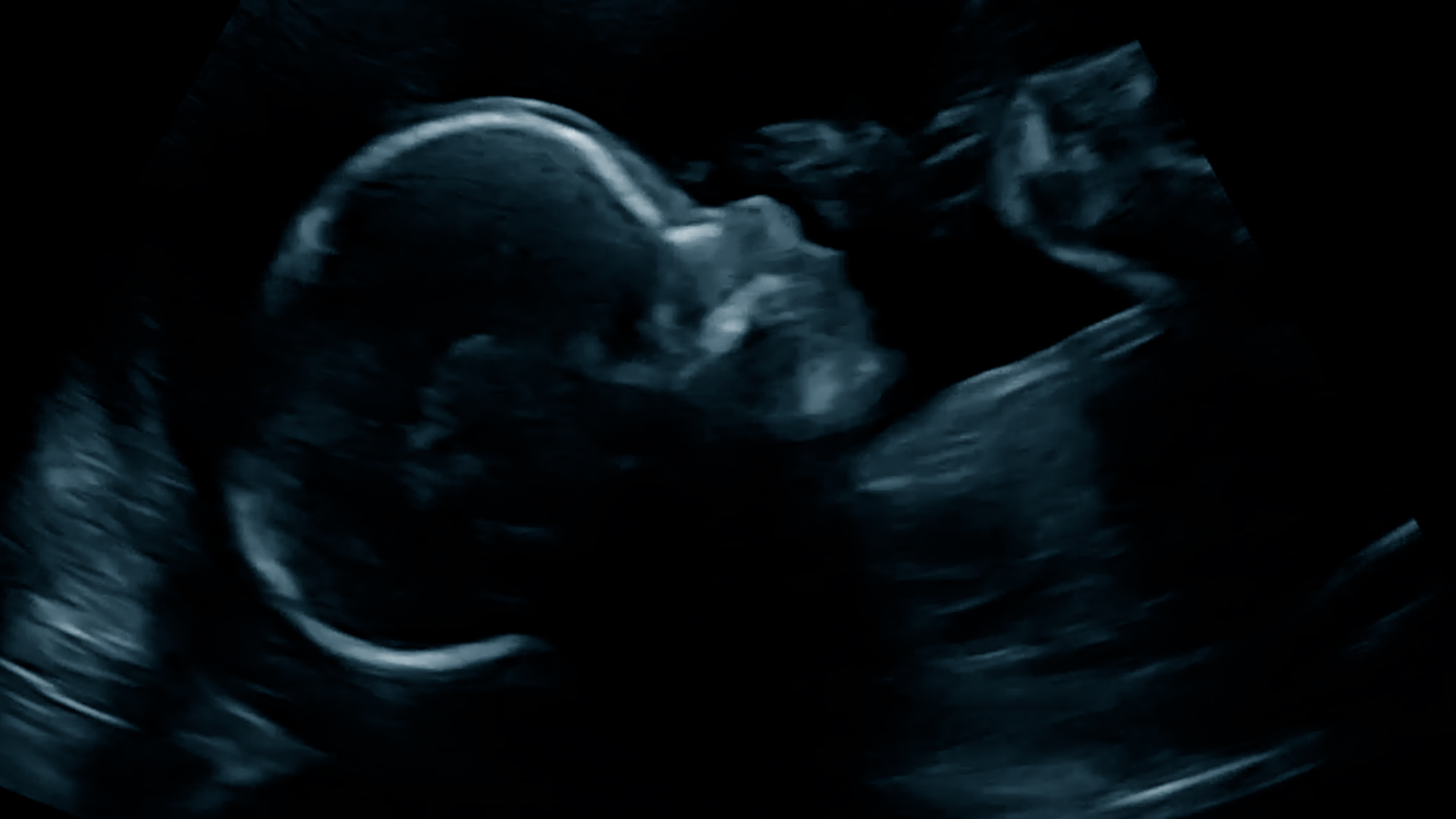 Anomaly Scan - The Ultrasound Suite